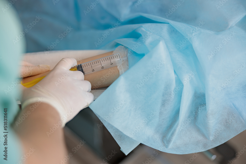 Hands of the doctor anesthesiologist makes an injection for pain before ...