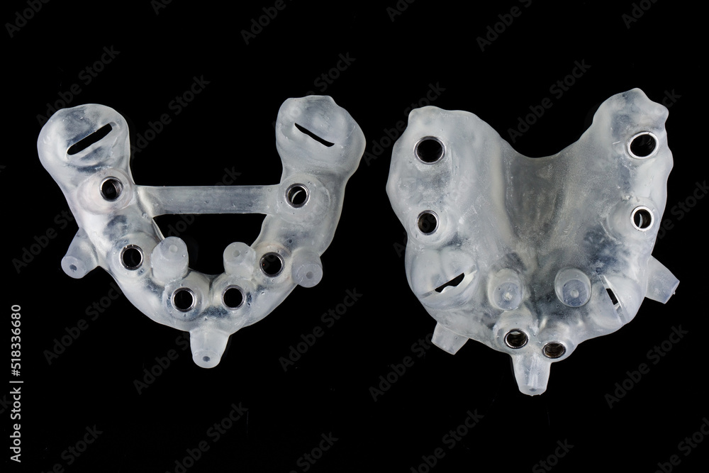 two surgical templates for total implantation of the upper and lower ...