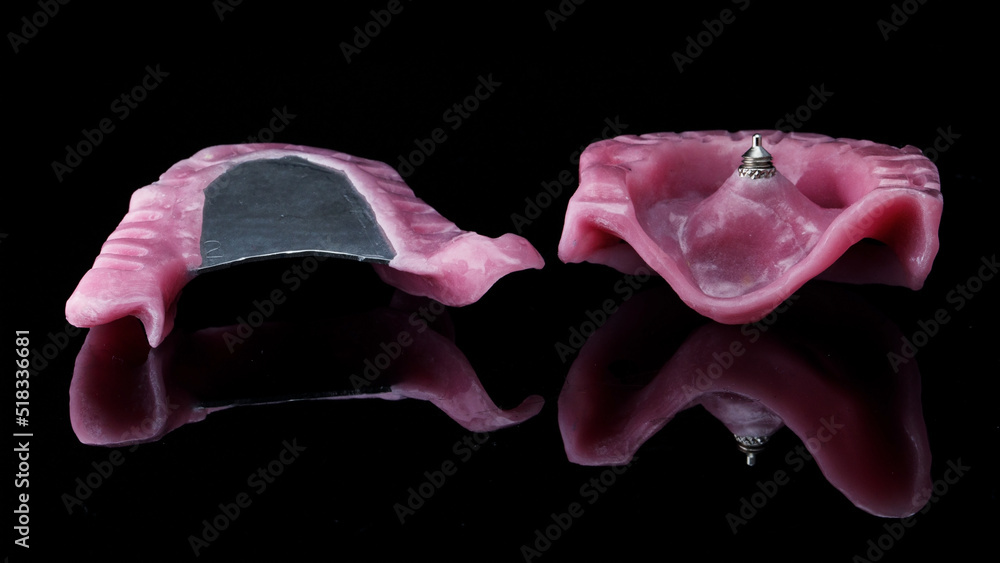 two parts of dental models for registering the bite of the patient's ...