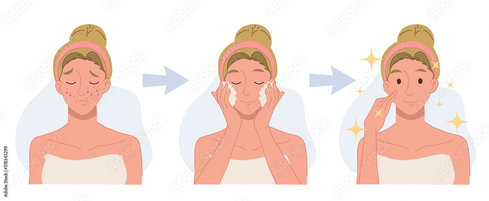 treat acne,skin problem,pimple .woman face.Beautiful.before after,step ...