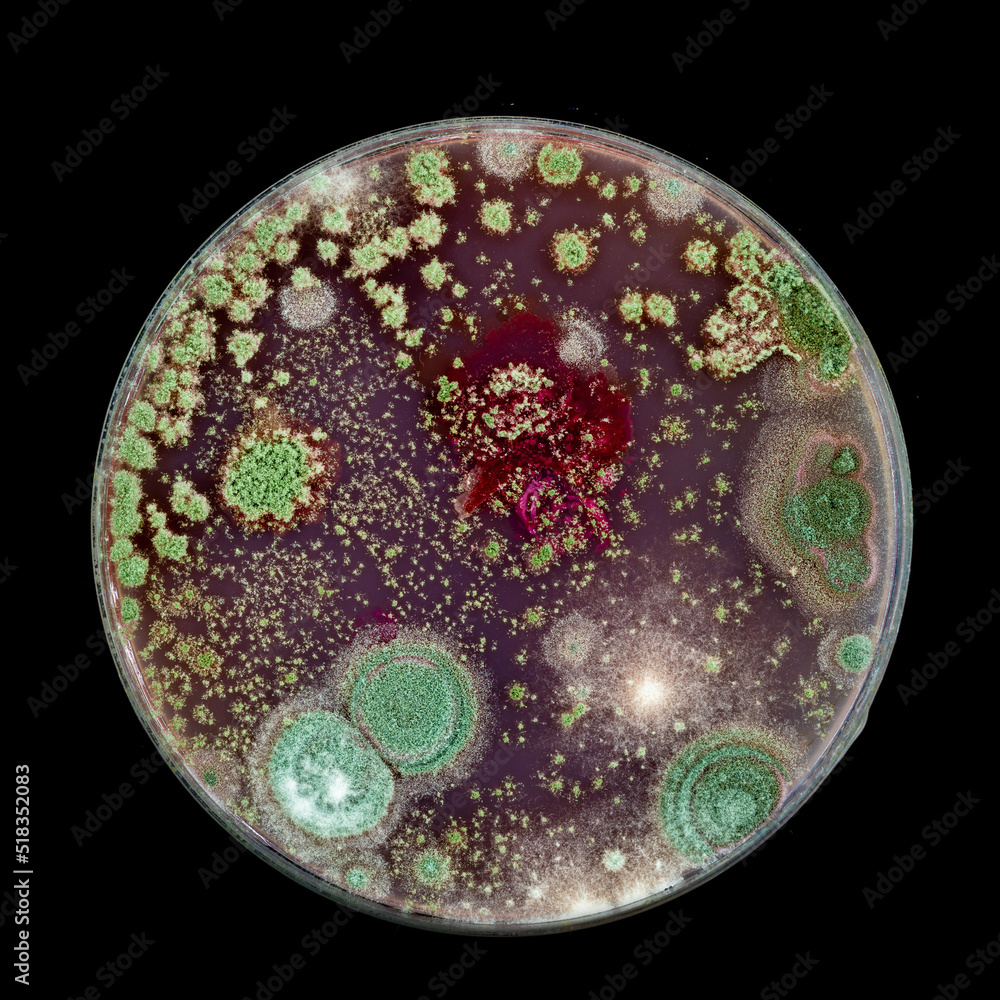 Samples of Petri dishes with a culture of microorganisms and fungi in the surface of agar ...