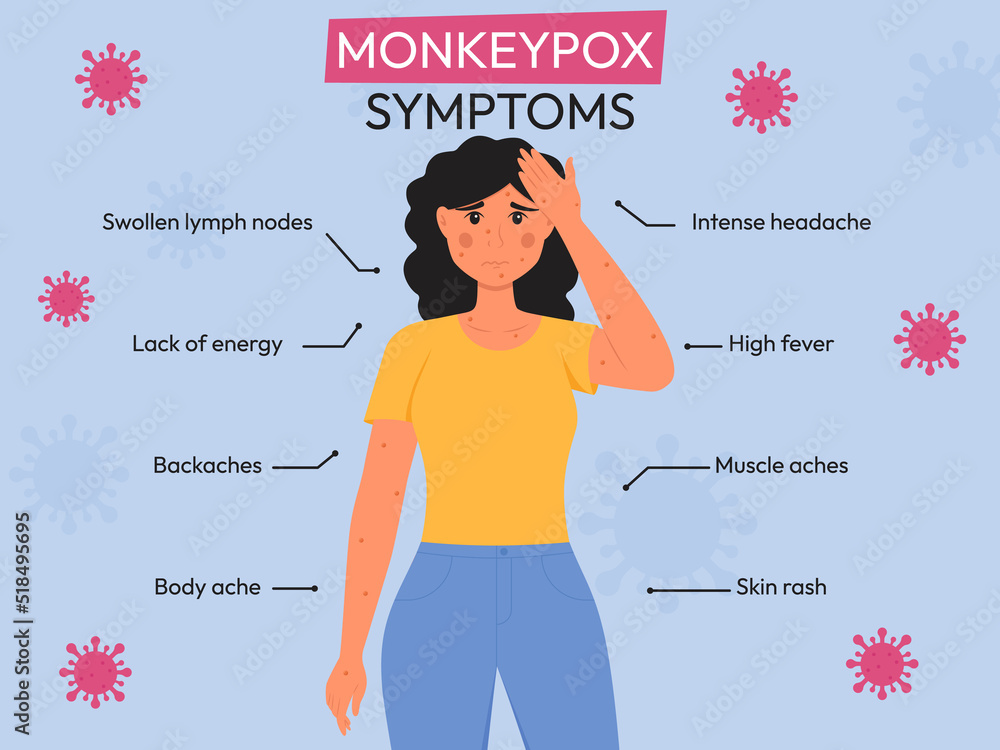 Monkeypox outbreak. Monkeypox virus symptoms infographic. Flat vector ...
