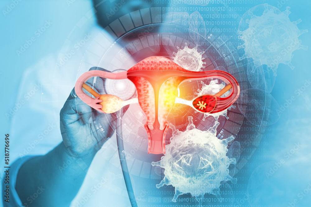 Poster Doctor check and diagnose the Female reproductive system ...