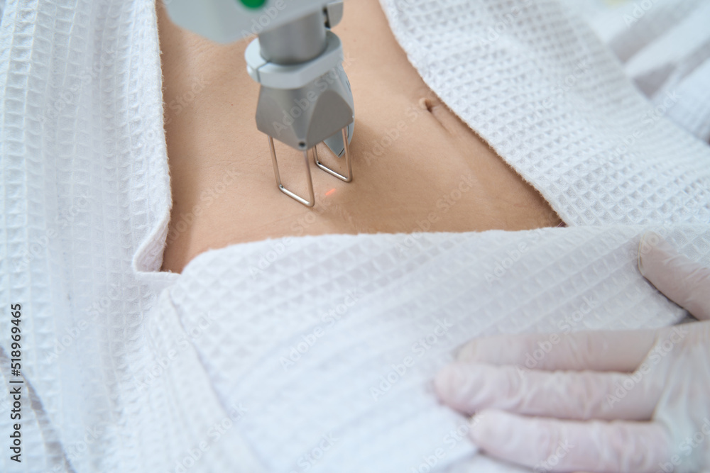 Laser removal of neoplasms is a non-surgical method for removing skin ...
