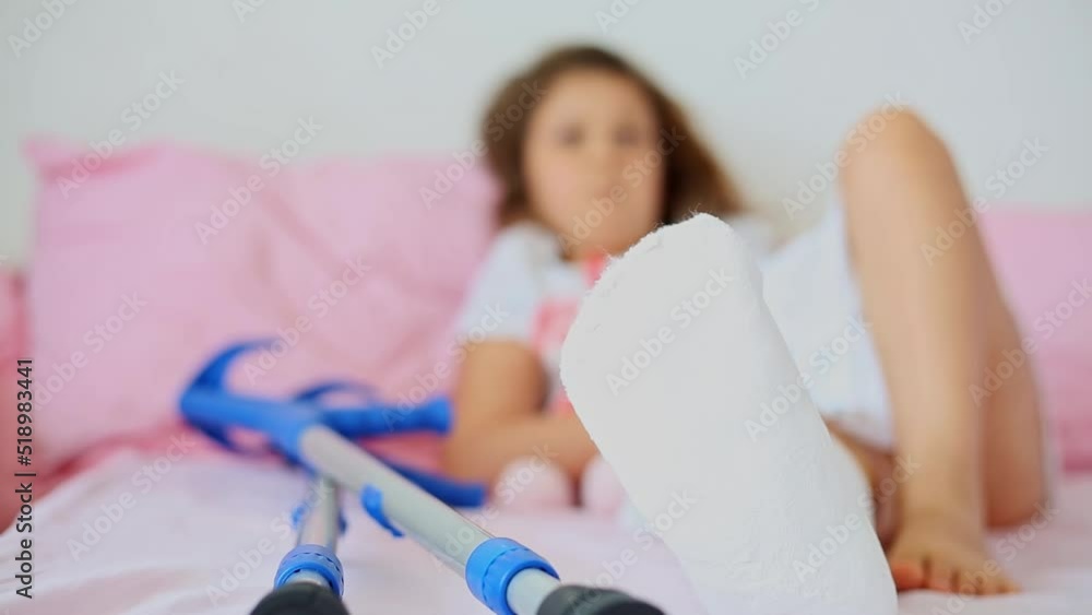 Unrecognizable little girl with a broken leg at home on a bed with ...