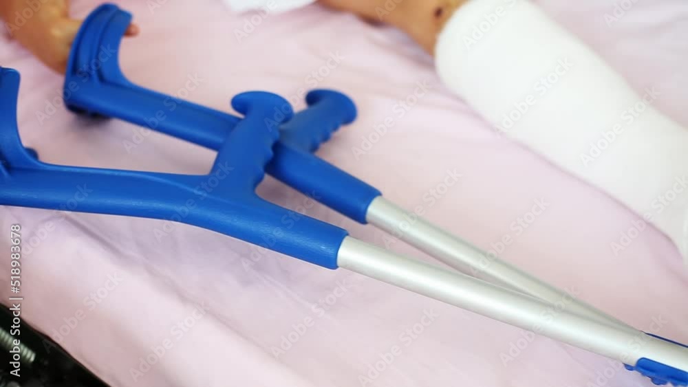 Broken leg in a cast in a young child. Unrecognizable little girl with ...