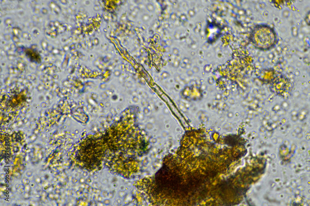 soil microbes organisms in a soil and compost sample, fungus and fungi ...