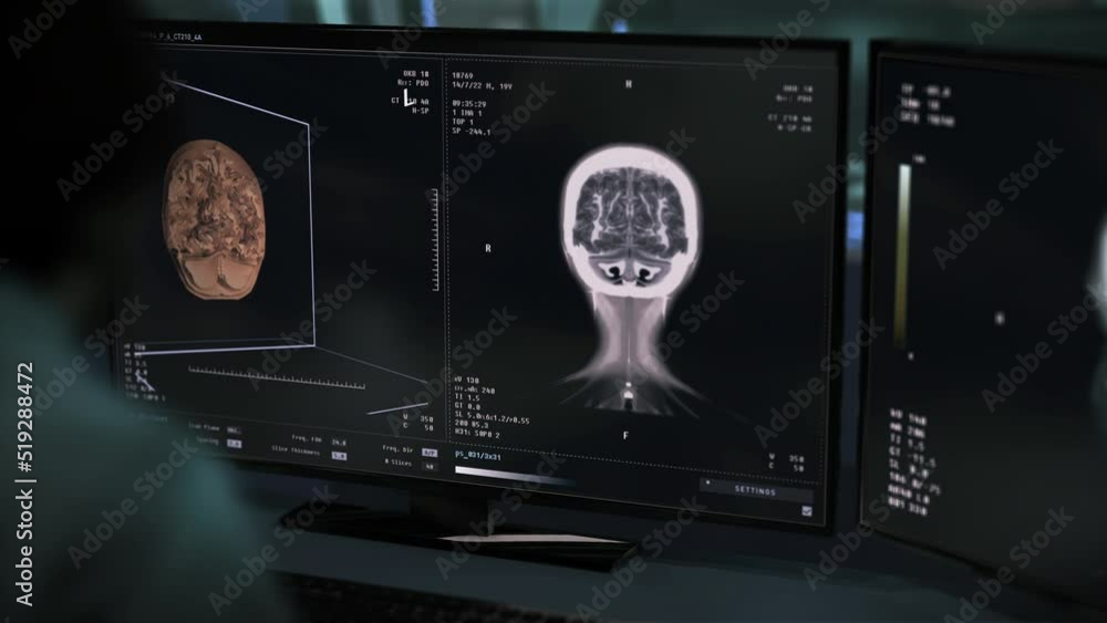 Diagnostic x-ray software scanning the emergency patients skull. X-ray ...
