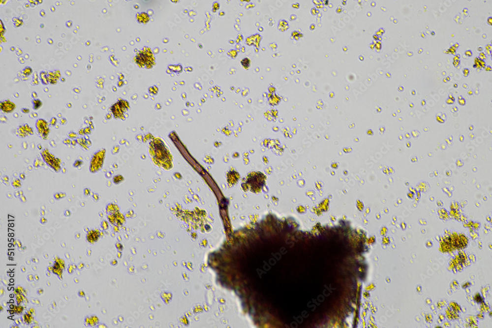soil microbes organisms in a soil and compost sample, testate amoebae ...