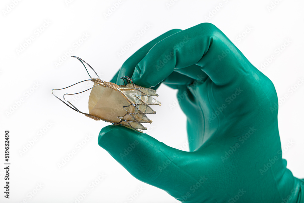 Heart valve surgery cardiology for patient in hospital. Prepare ...