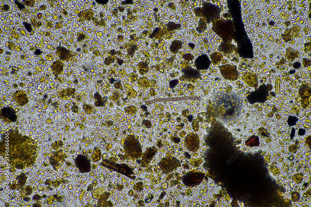 soil microbes organisms in a soil and compost sample, testate amoebae ...
