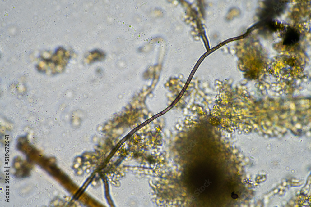 Foto de Fungal and fungi hyphae under the microscope in the soil and ...