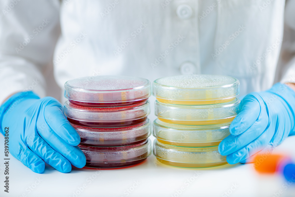 Microbiology lab work. Stacks with Petri dishes containing bacterial ...