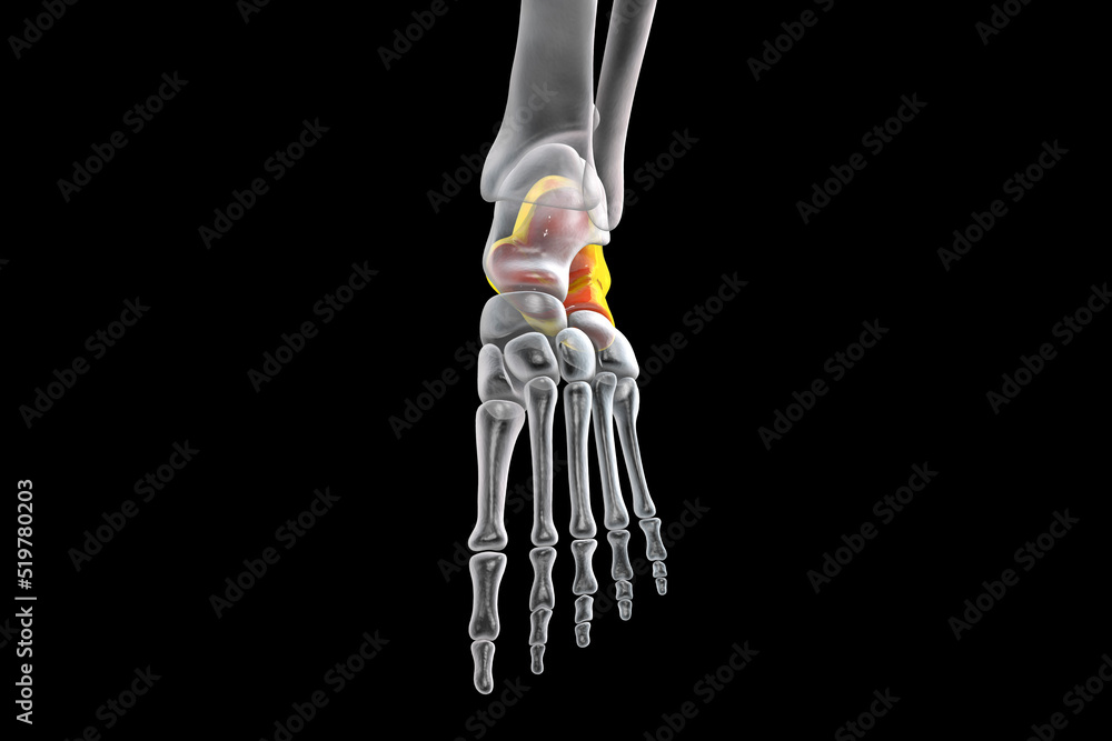 Human foot anatomy. Calcaneus bone of the foot ilustração do Stock ...