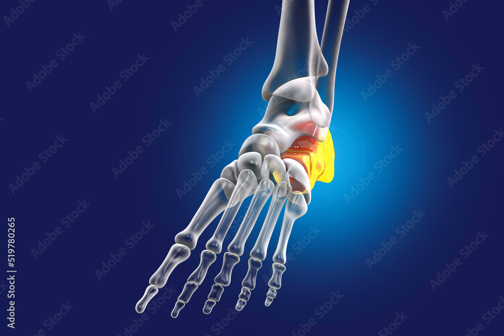 Human foot anatomy. Calcaneus bone of the foot Stock Illustration ...