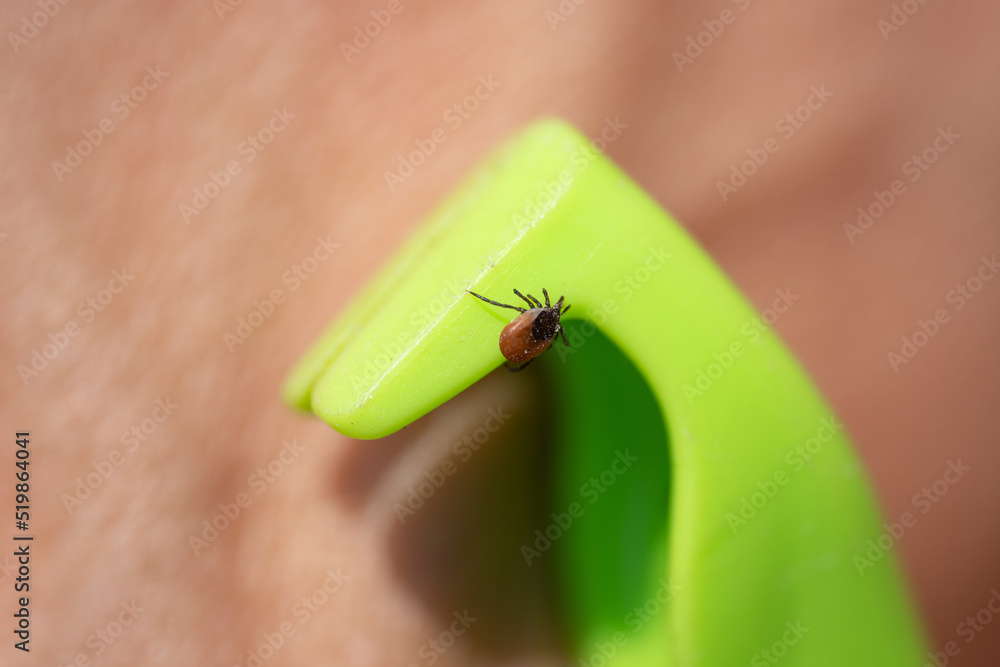 Tick sitting tick remover. Ixodes ricinus or scapularis. Close-up of ...