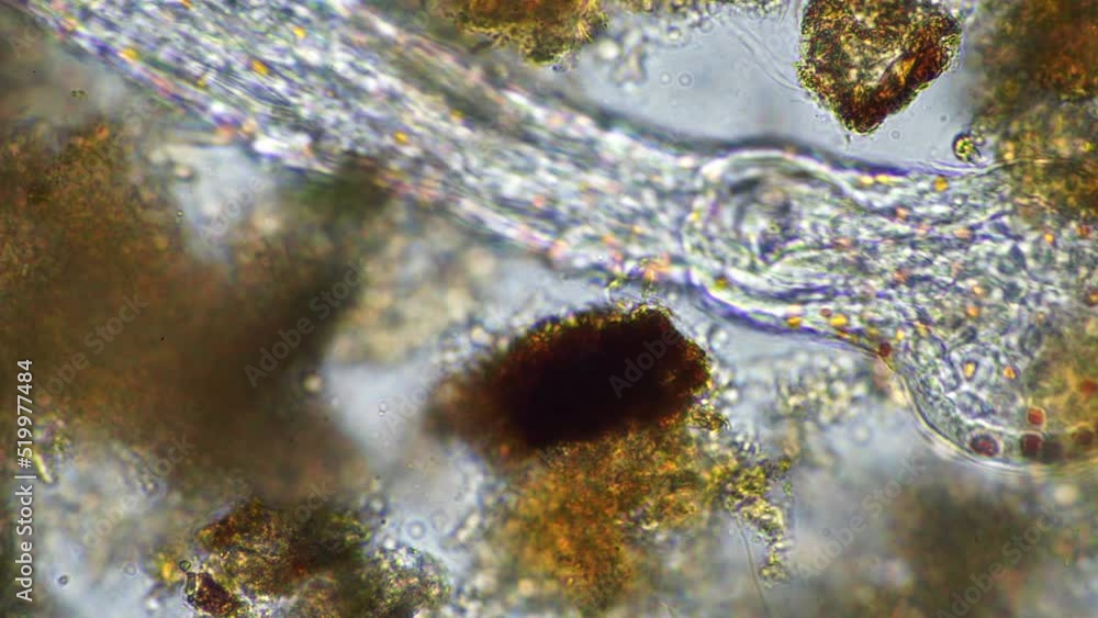 Soil microorganisms under the microscope. Soil sample being tested by a ...