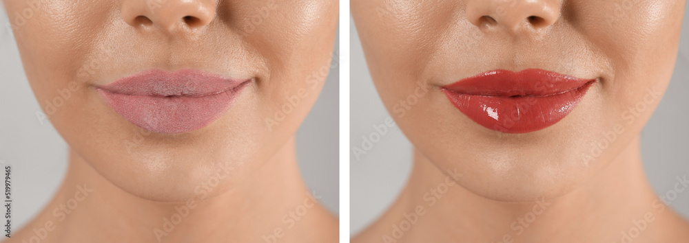 Collage with photos of woman with dry and moisturized lips, closeup ...