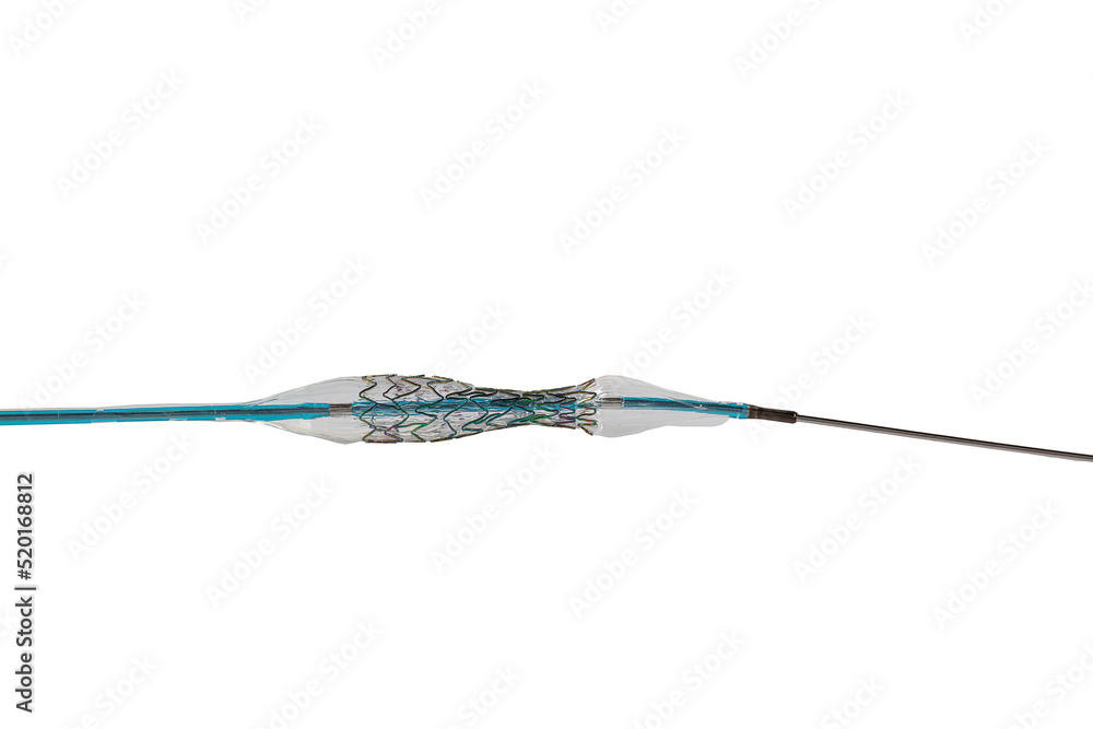 Heart Stent angioplasty. Stent and catheter for implantation into blood ...