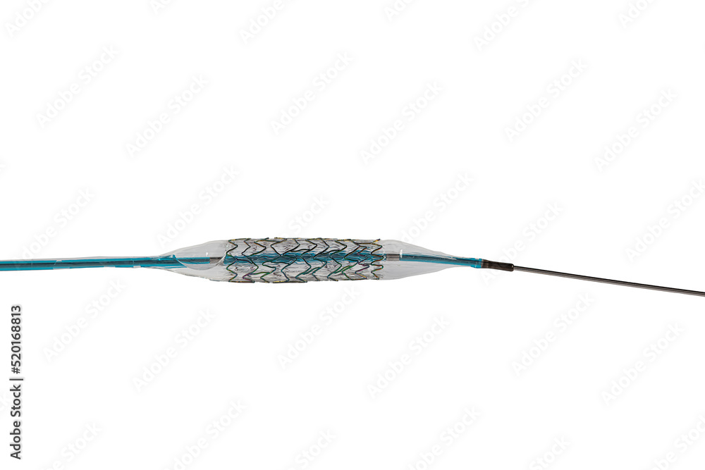 Heart Stent angioplasty. Stent and catheter for implantation into blood ...