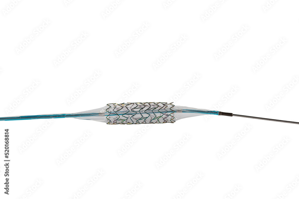 Heart Stent angioplasty. Stent and catheter for implantation into blood ...