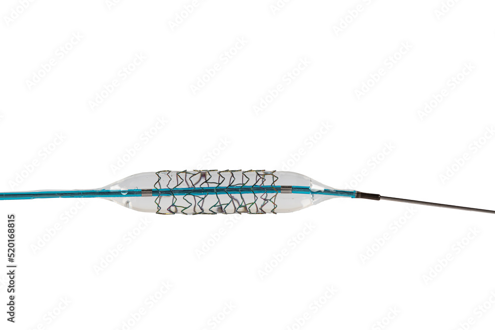 Heart Stent angioplasty. Stent and catheter for implantation into blood ...