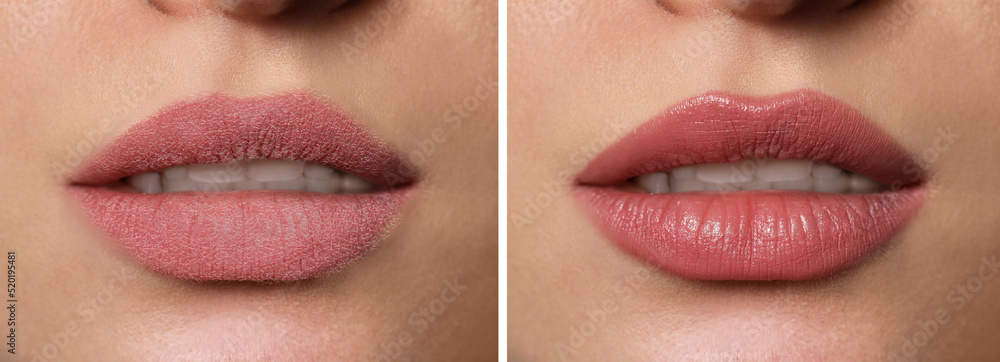 Collage with photos of woman with dry and moisturized lips, closeup ...