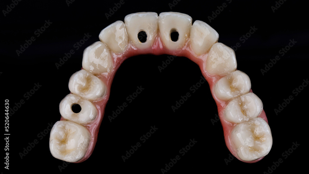 View from above on the morphology of the teeth of the prosthesis of the ...