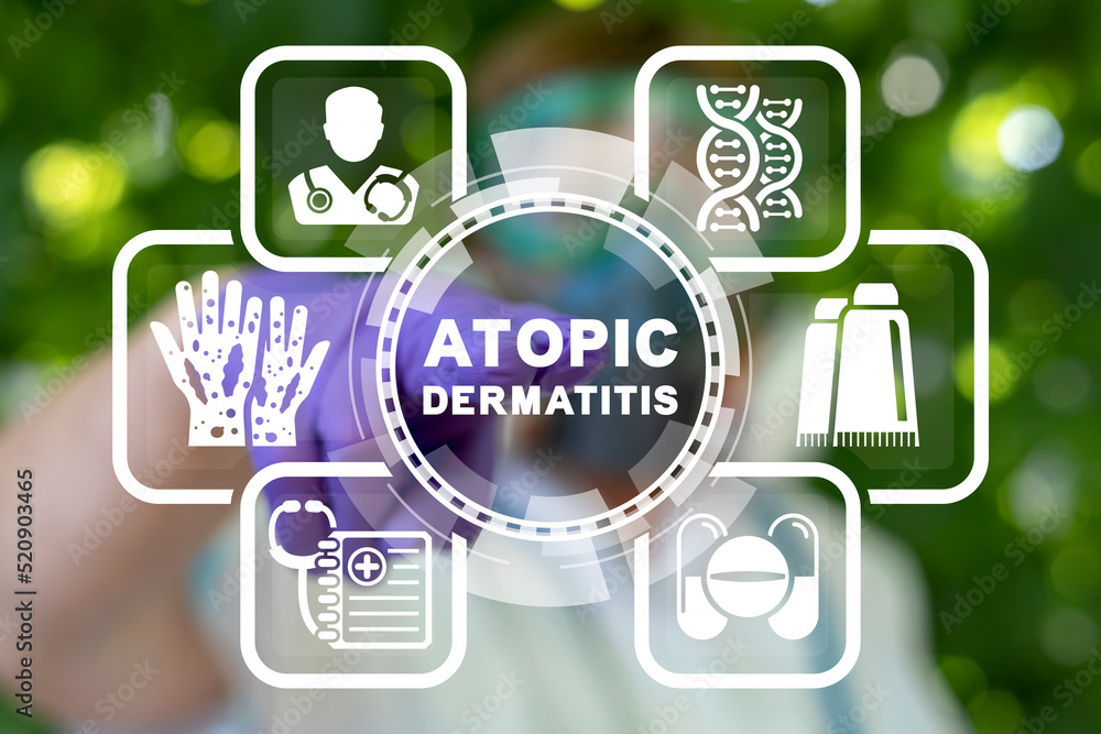 Concept of dermatology. Diagnosis and treatment of atopic dermatitis ...