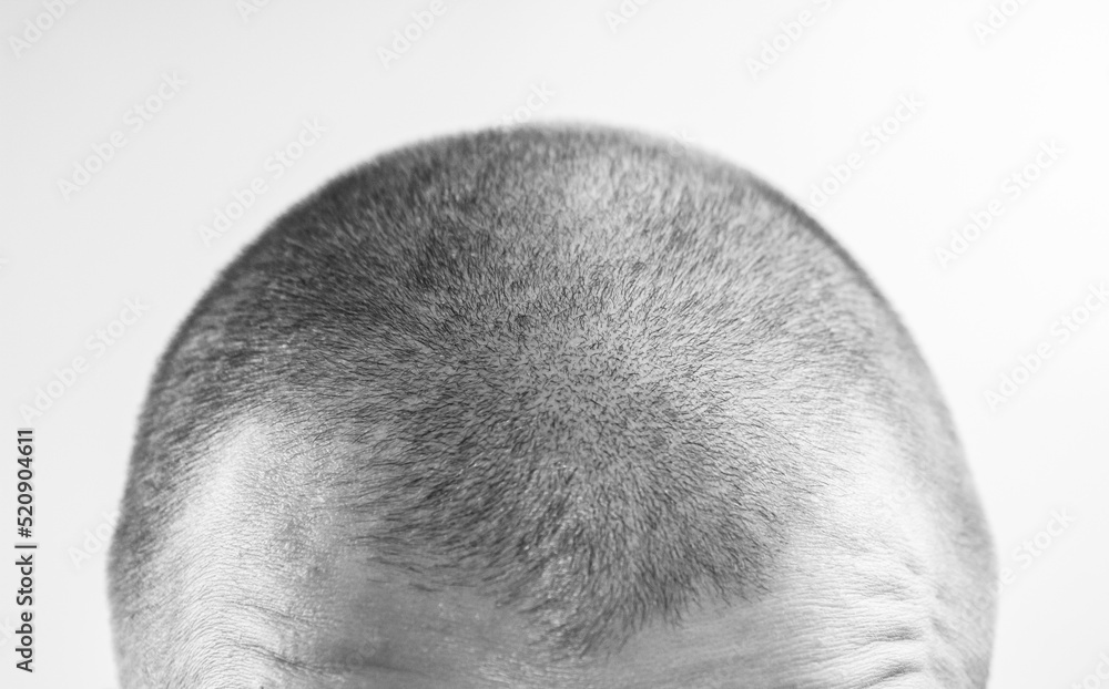 The Short haircut for men colorless. Short hair on the head of a man ...
