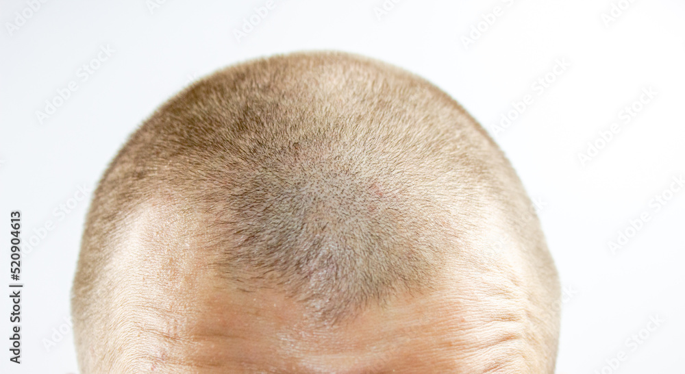 The Short haircut for men. Short hair on the head of a man.Layout, male ...