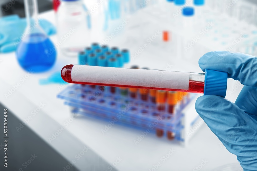 Positive blood infection sample in test tube for CENTAURUS BA 2.75 ...