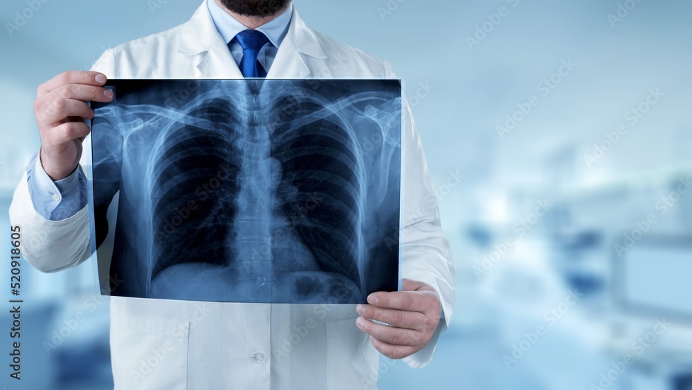 A surgeon doctor examining patient's x-ray films, scan in at radiology ...