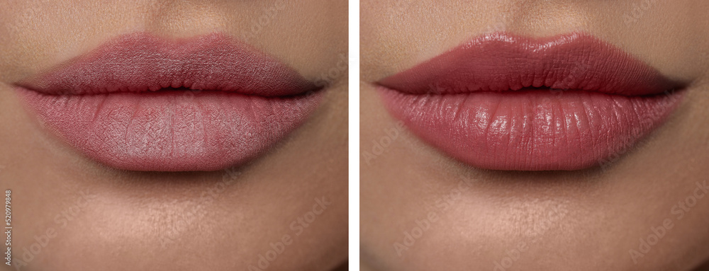 Collage with photos of woman with dry and moisturized lips, closeup ...