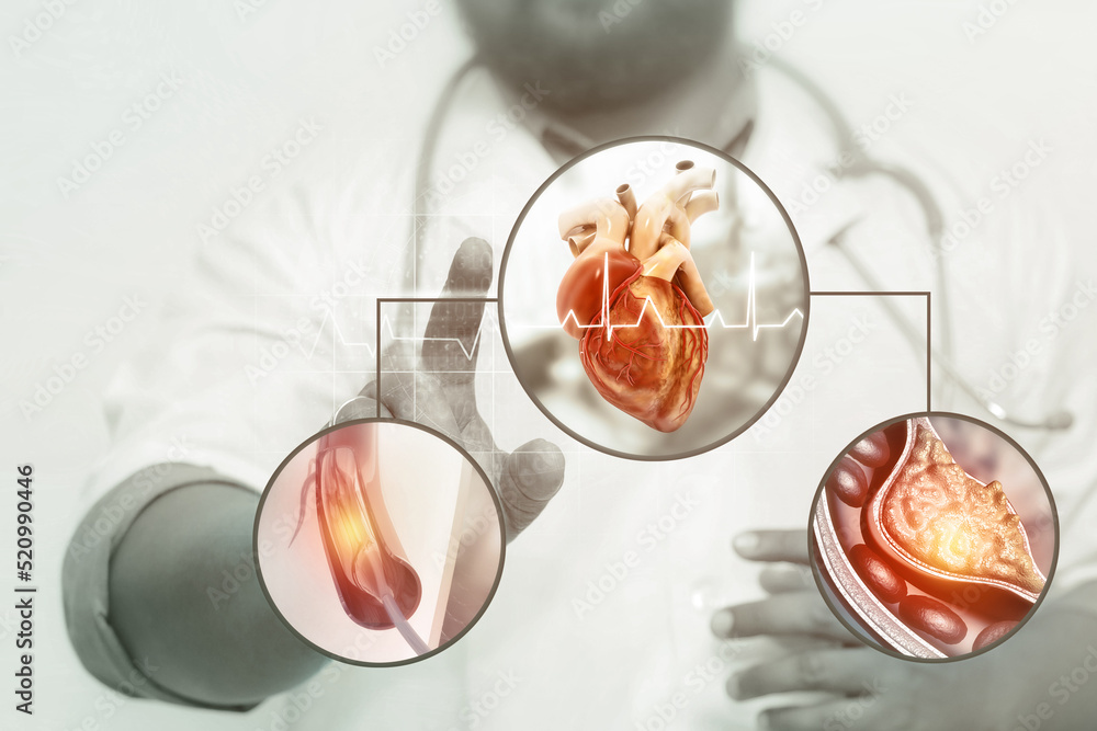 Poster Doctor check and diagnose the human heart diseases – Wall Art ...