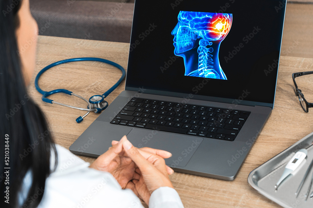 Doctor showing a x-ray of pain in the brain on a laptop. Migraine ...