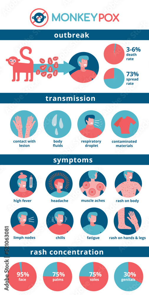 Monkeypox virus detailed infographics. Symptoms, transmission, rash ...