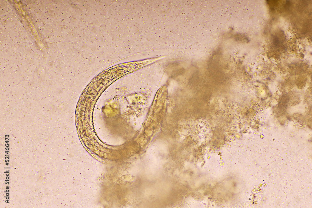 Strongyloides stercoralis or threadworm in human stool, analyze by ...