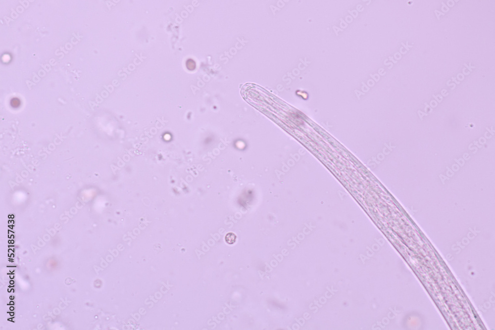 View in microscopic Strongyloides stercoralis or threadworm in human ...