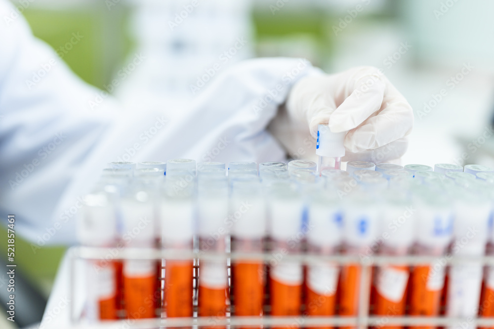 Scientist hand with a tube of blood sample and a rack with other ...