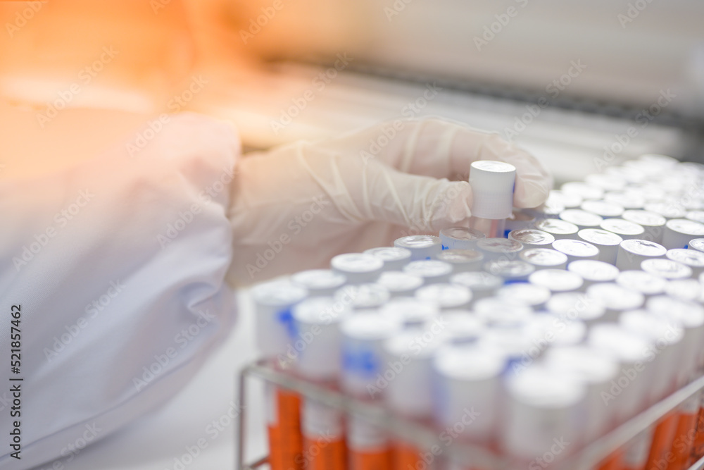 Scientist hand with a tube of blood sample and a rack with other ...