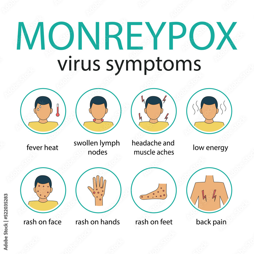 Monkeypox virus symptoms. Monkeypox virus detailed infographic ...