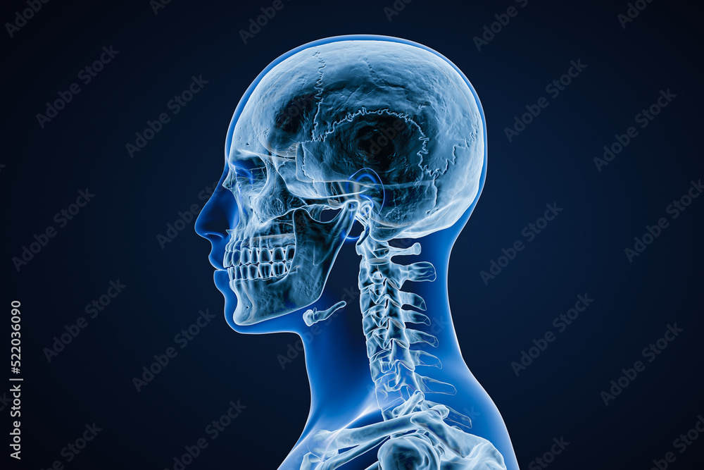 Xray image of lateral or profile view of skull of adult male with body ...