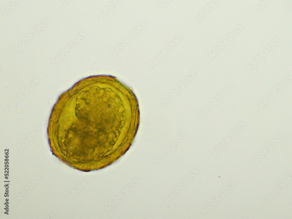 Poster Egg of Ascaris lumbricoides (roundworm) in human stool, analyze ...