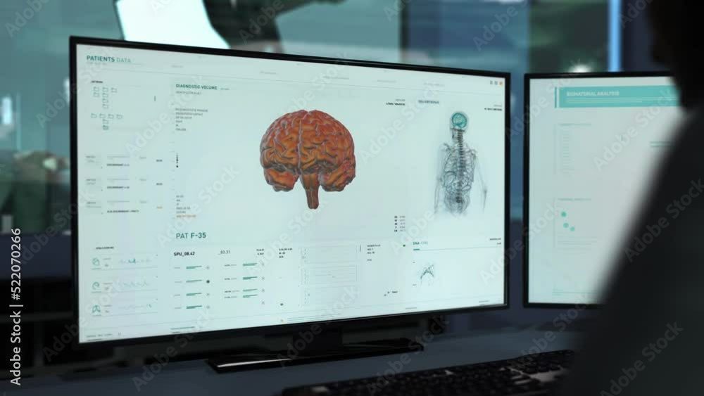 Doctor Using X-ray Diagnostic Medical Analysis To Scan Patients Brain ...