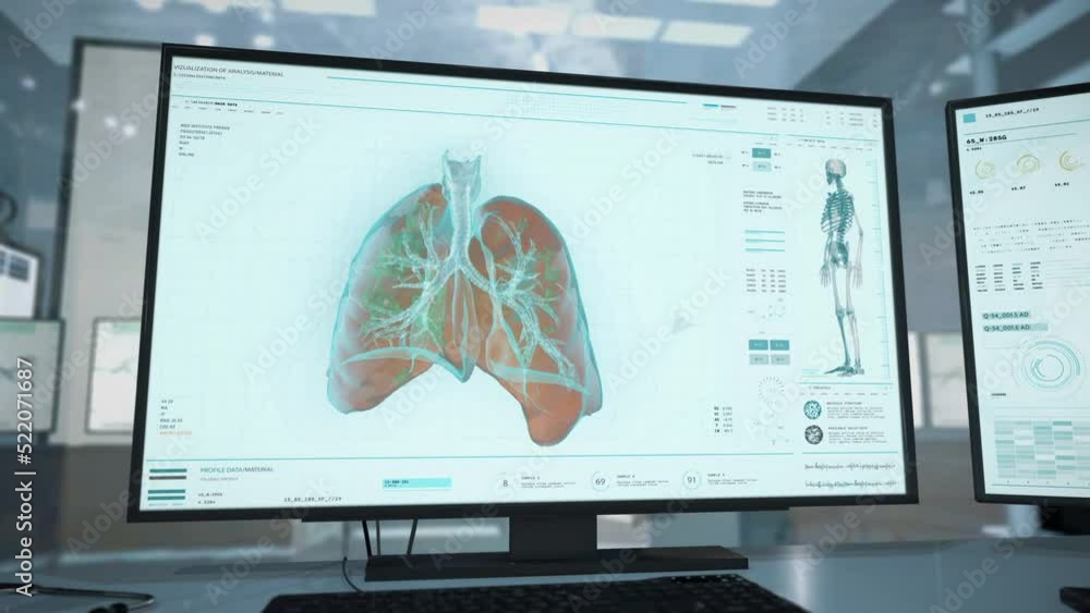 Innovative Hospital Analysis Equipment Starts Scan To Find Epidemic ...