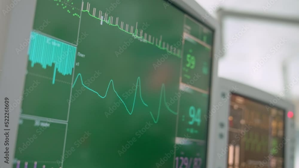 Lines and numbers changing at the screen of medical equipment. Monitor ...