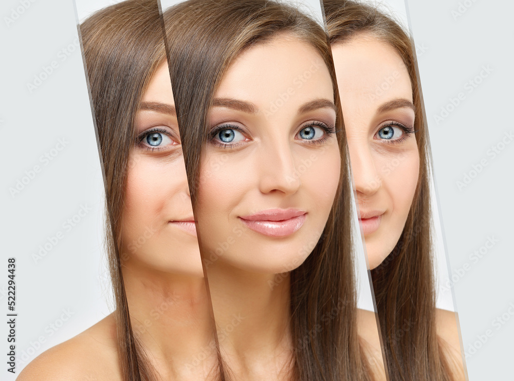 Effects of ageing,Frownscowl lines ,Nasolabial folds,Neck ,Under eye ...