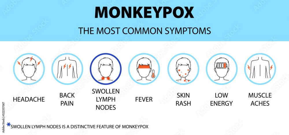 Monkeypox virus symptoms icons infographic. Headache, back pain ...
