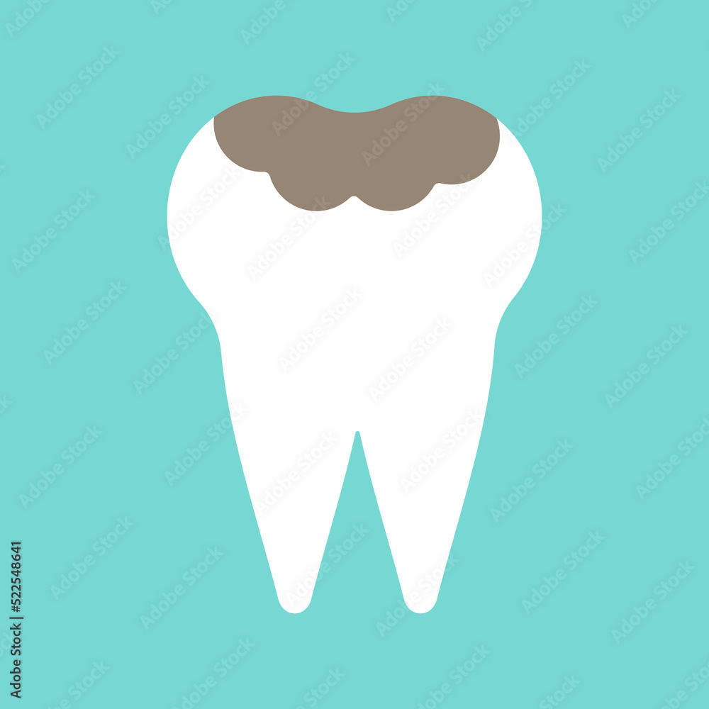 tooth with caries. Tooth decay. Bad tooth. Dental care background ...